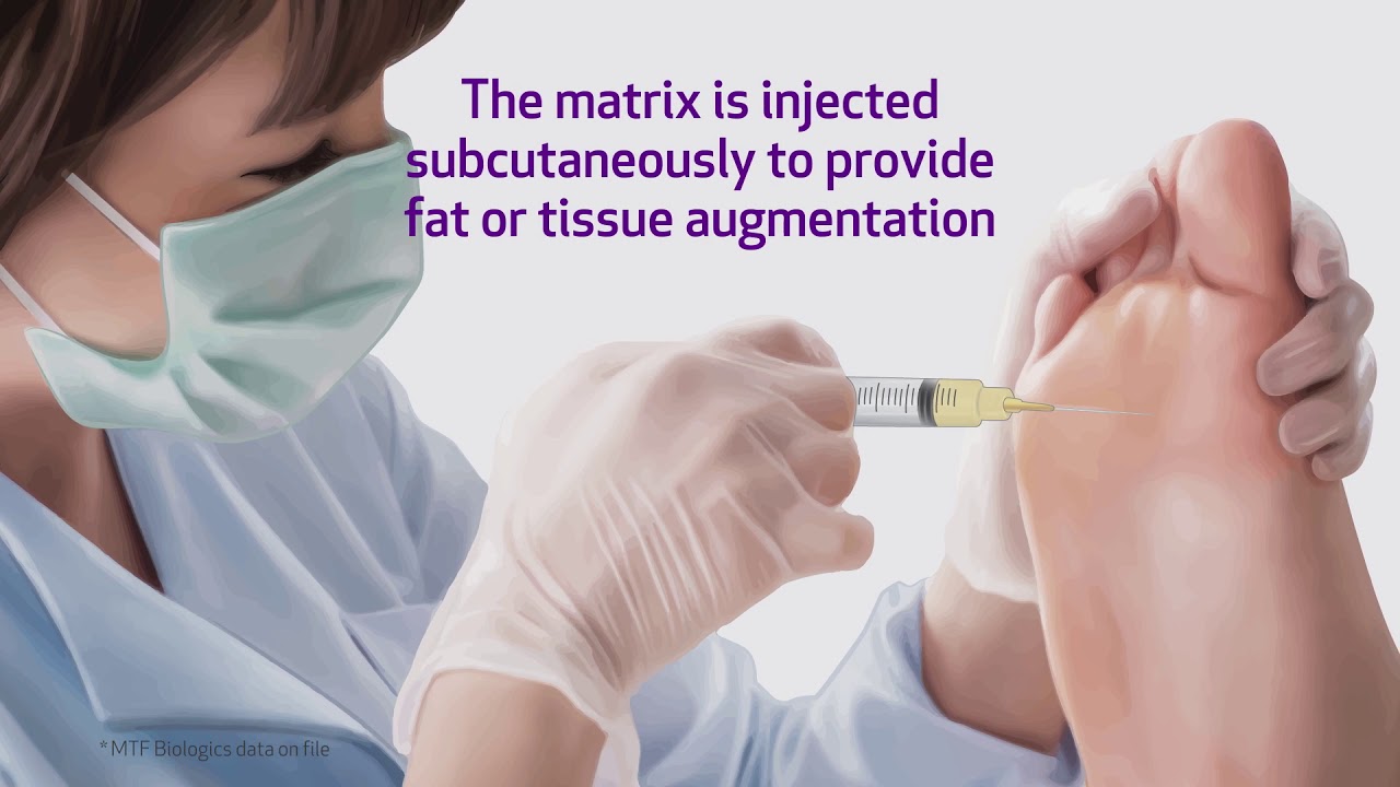 Revolutionizing Foot Care: The Benefits of Leneva Injections for ...